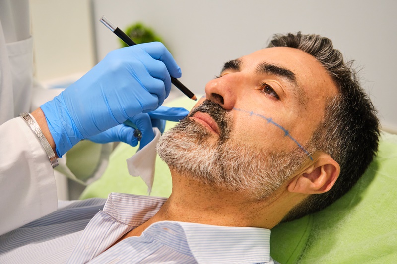 Operación de pómulos: claves, beneficios y recuperación